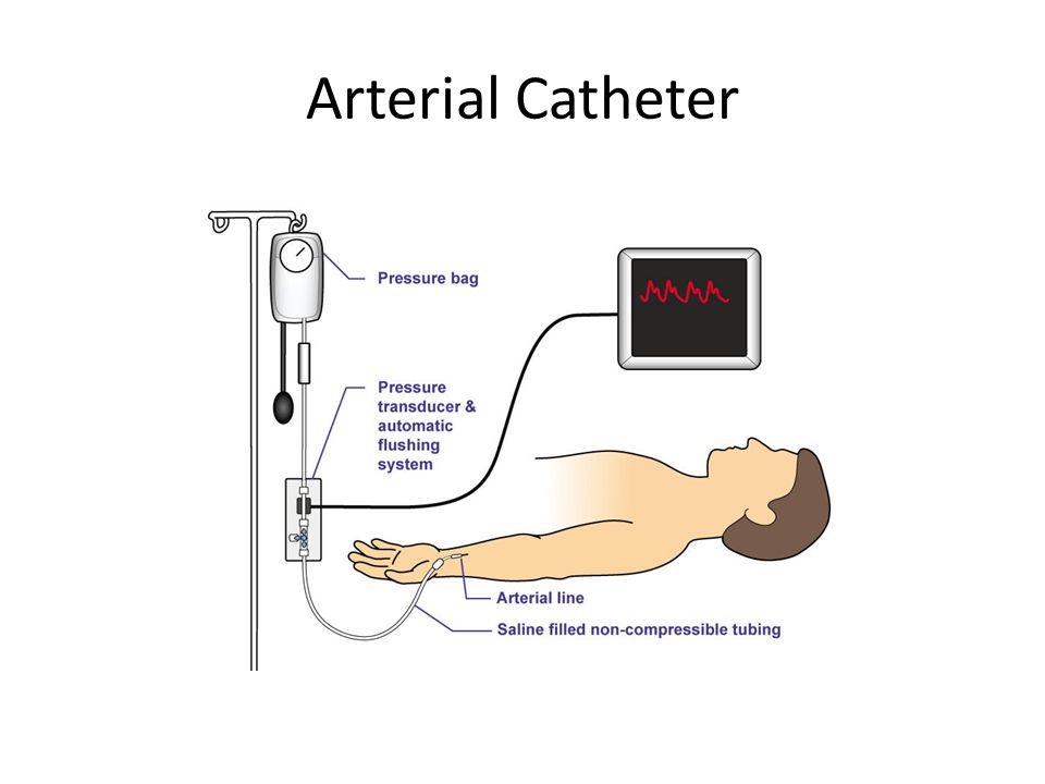 Infusion Therapy Metropolitan Community College Fall 2013 Jane Miller Ppt Download