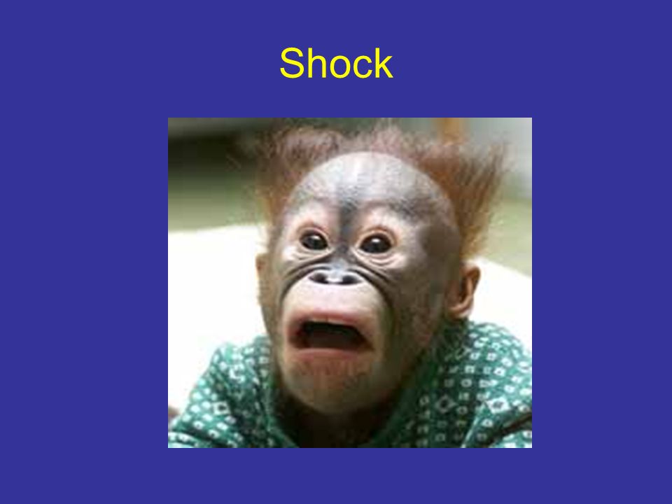 The Evaluation and Management of Shock Alberto Nunez, MD Hahnemann ... The Evaluation and Management of Shock Alberto Nunez, MD Hahnemann ...