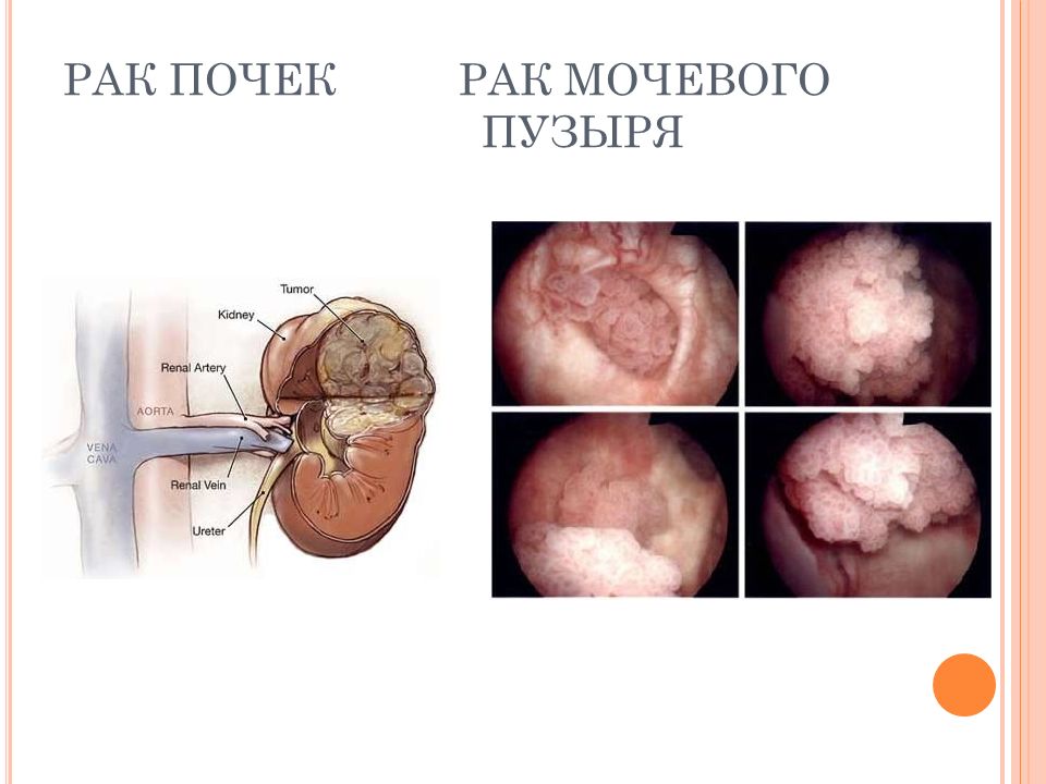 П РЕЗЕНТАЦИЯ З АЙЦЕВОЙ С Ю Г М ОСКВА ГОУСОШ №1350 Т ЕМА «ВРЕД